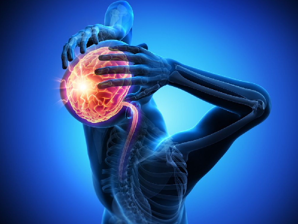 Courses – World Headache Society